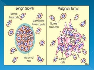 Benign Tumor Cells