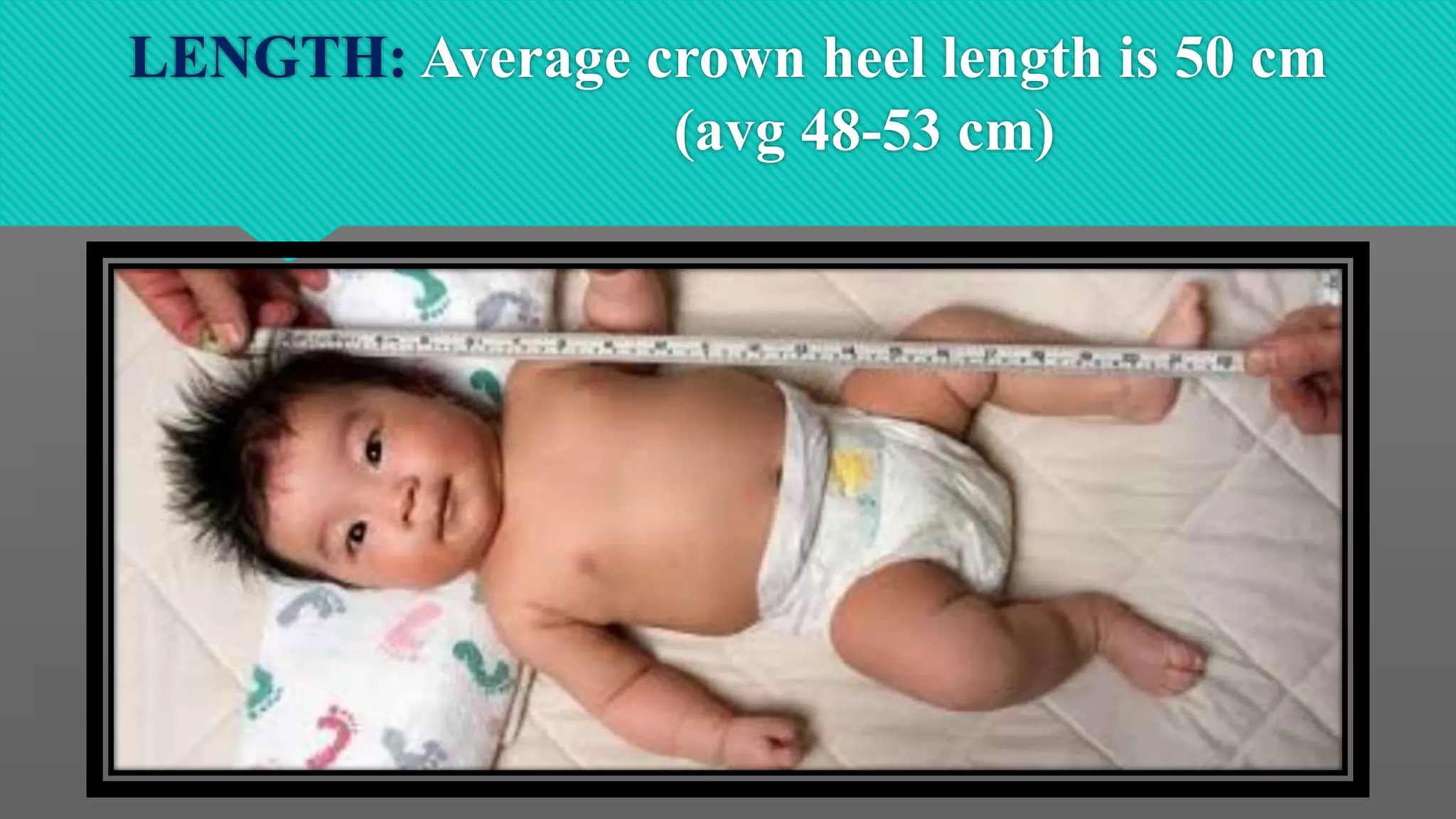 Characteristics of a Healthy Newborn | PPTX