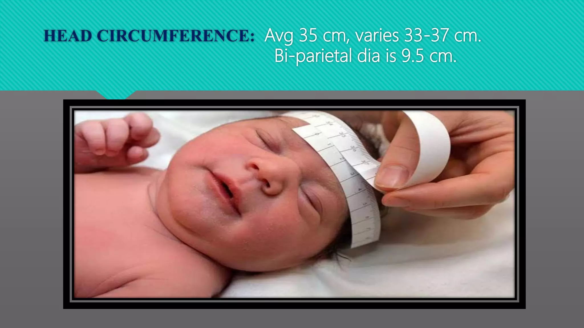 Characteristics of a Healthy Newborn | PPTX