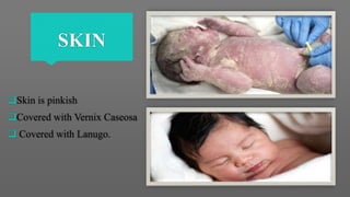 Characteristics of a Healthy Newborn | PPTX