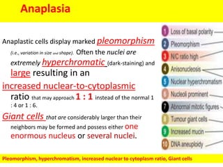 Characteristics of neoplasms | PPTX