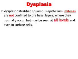 Characteristics of neoplasms | PPTX