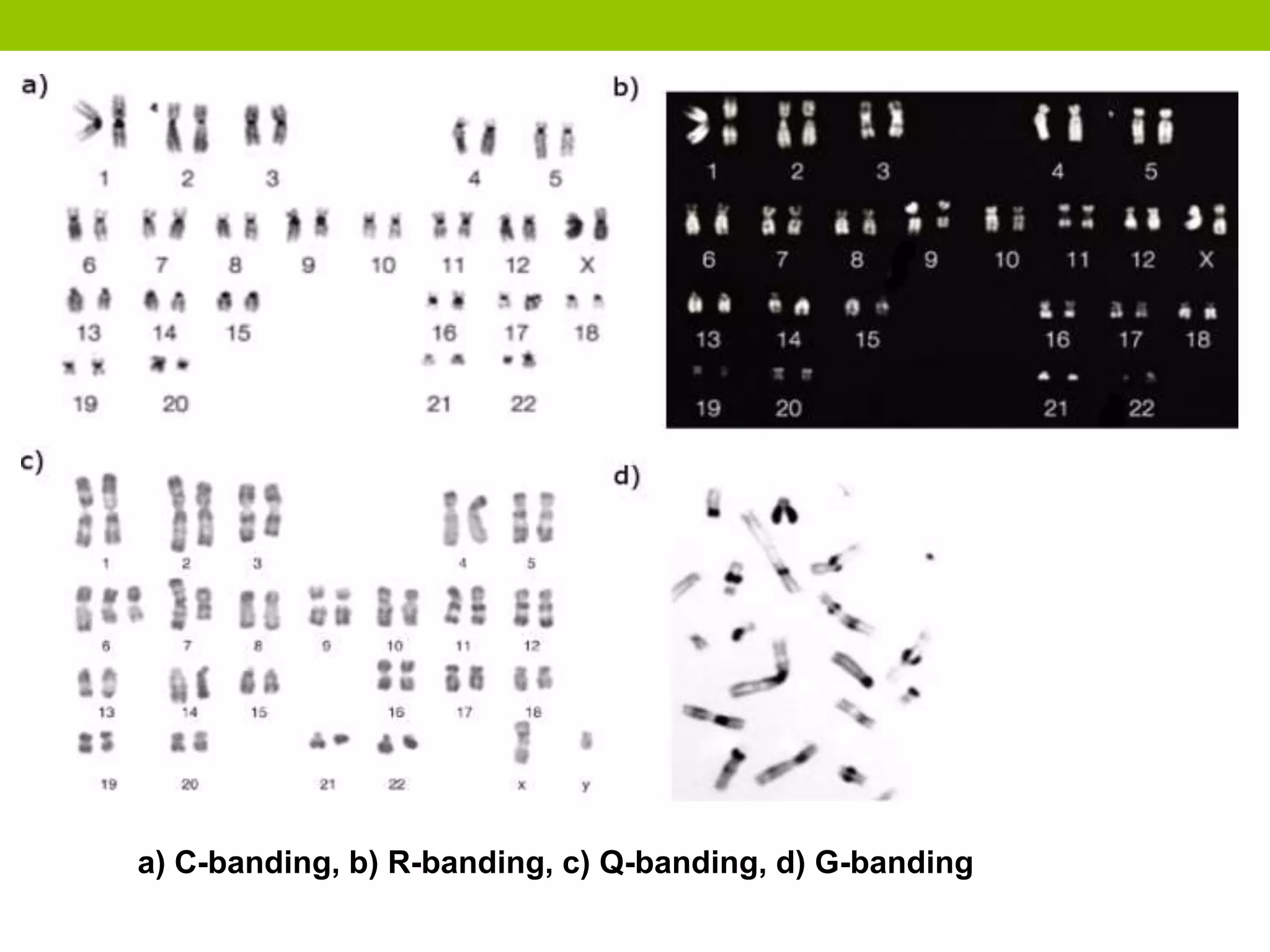 Characterization of cell line by Cell morphology, Chromosome analysis ...