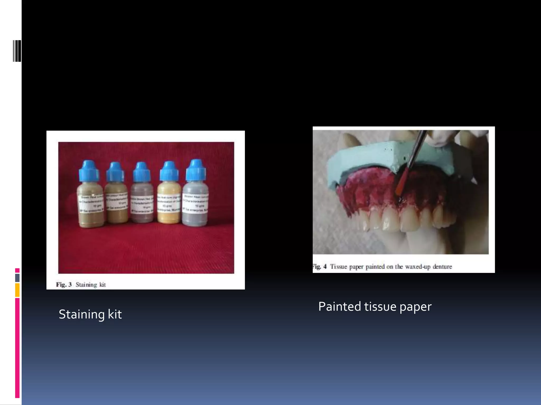 Characterization of complete denture | PPTX
