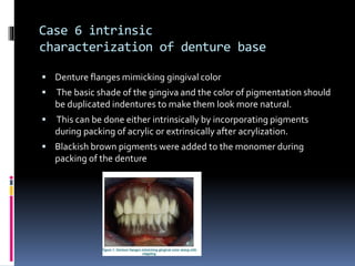 Characterization of complete denture | PPTX