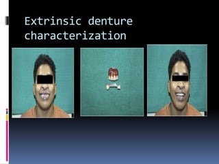 Characterization of complete denture | PPTX