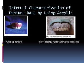 Characterization of complete denture | PPTX