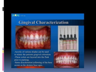 Characterization of complete denture | PPTX