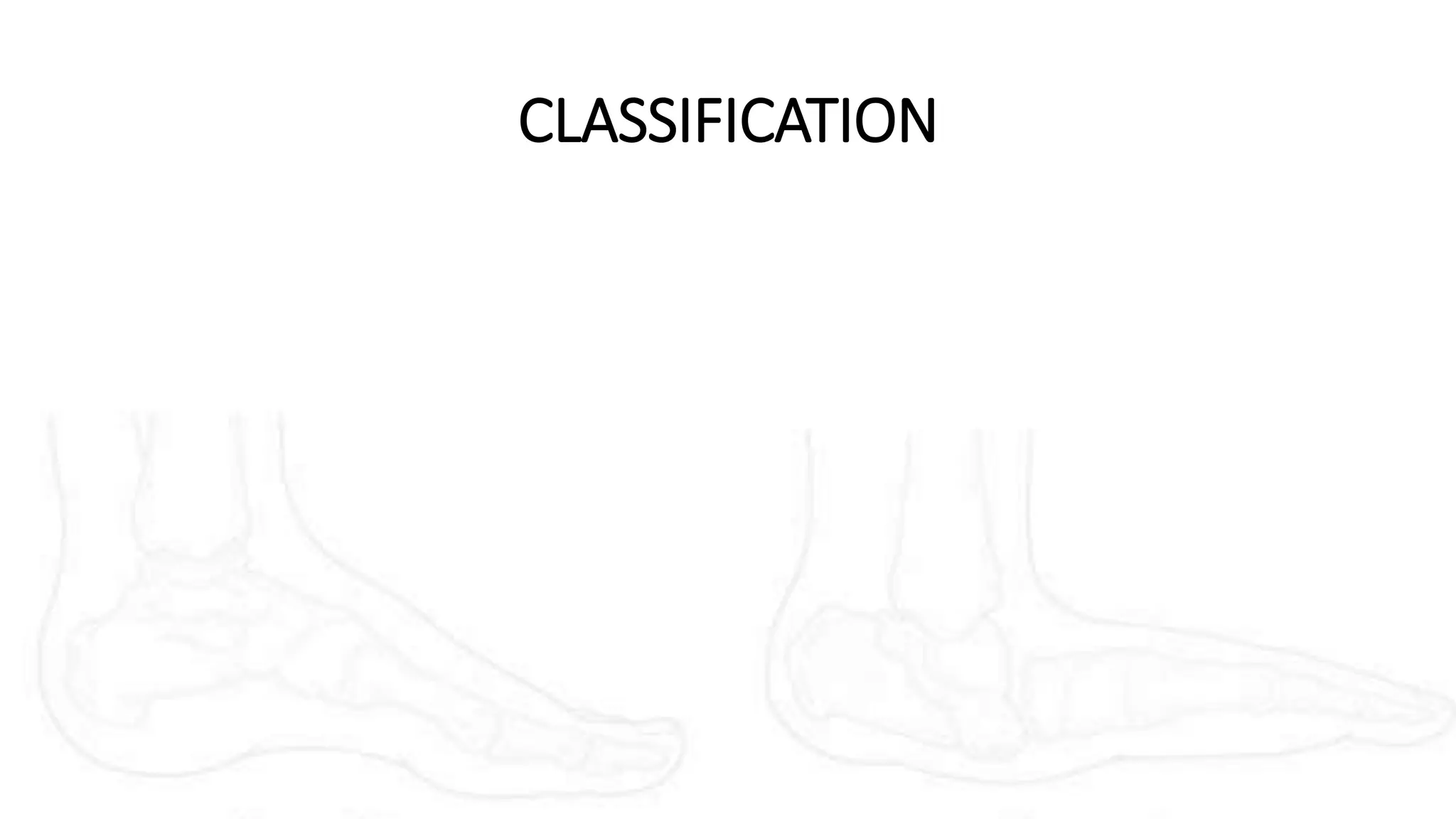 Charcot foot | PPTX