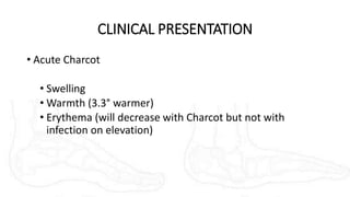 Charcot foot | PPTX