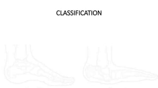 Charcot foot | PPTX