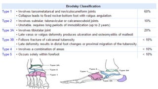 Charcot foot | PPTX