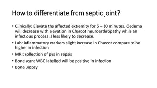 Charcot joint | PPTX