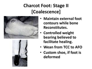 Charcot joint and methods of arthrodesis | PPTX