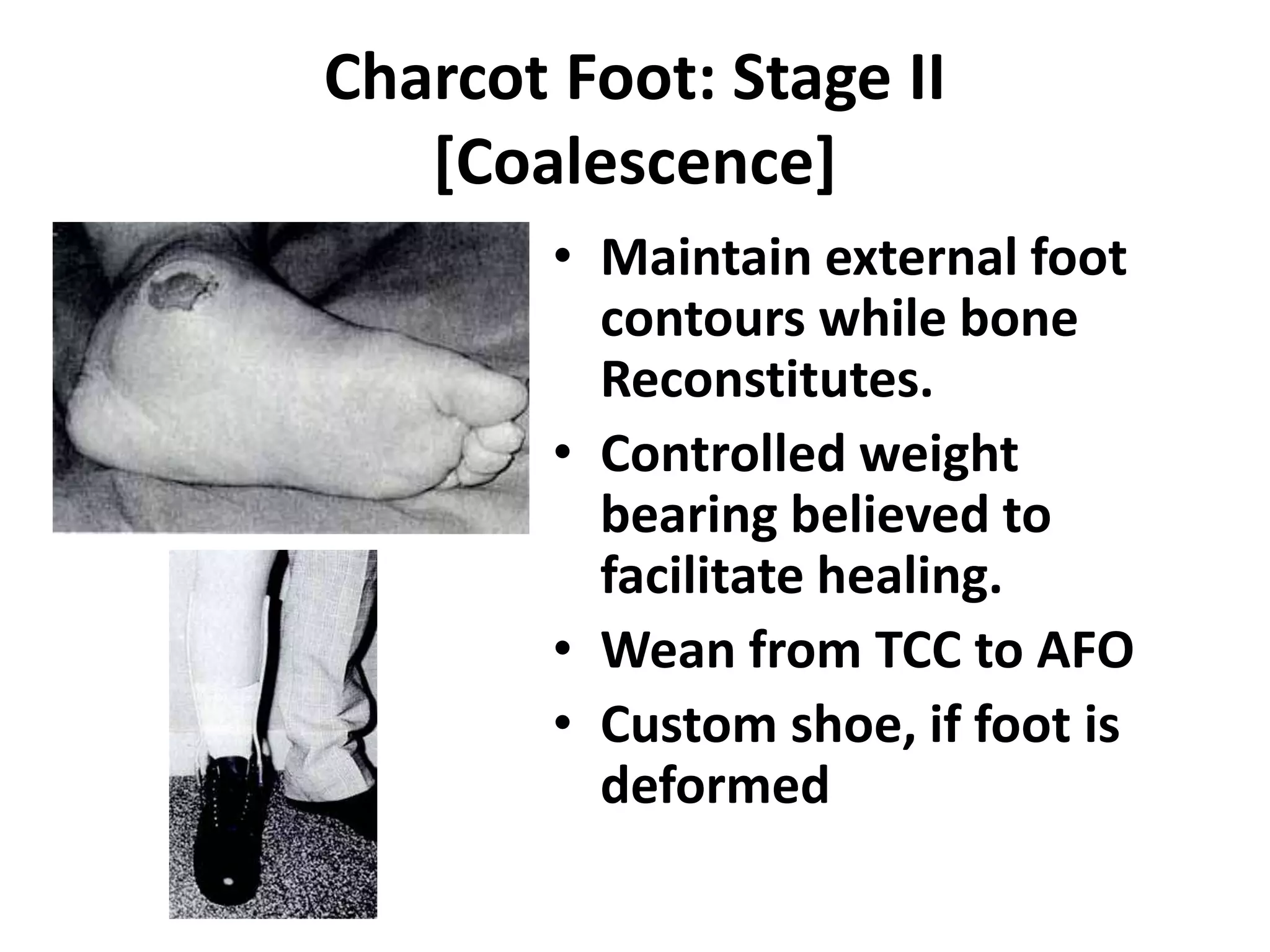 Charcot Joint & Methods of Arthrodesis.pptx