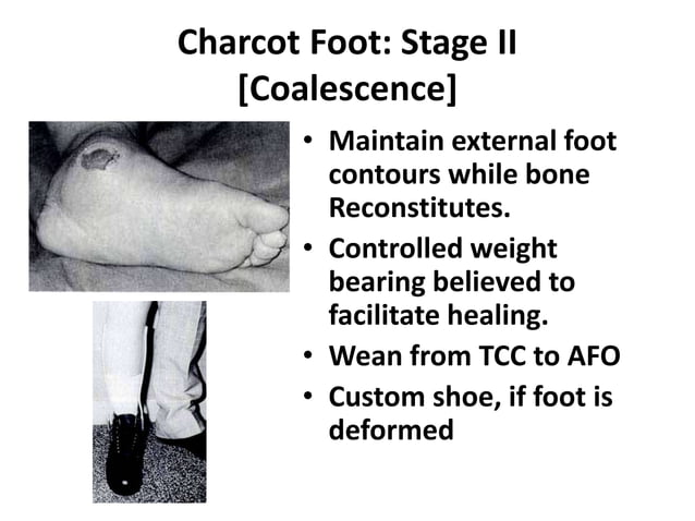 Charcot Joint & Methods of Arthrodesis.pptx