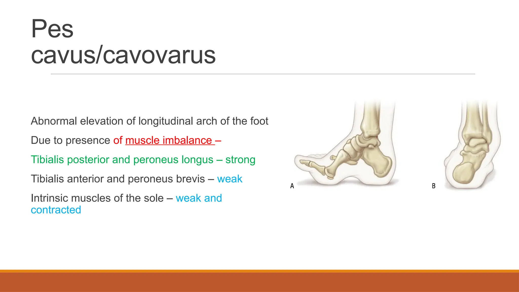 charcot marie tooth disease (CMT) pediatric.pptx | Death, Injury, or ...
