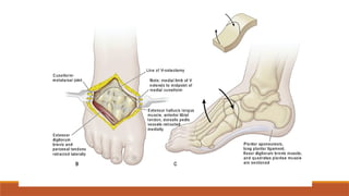 charcot marie tooth disease (CMT) pediatric.pptx