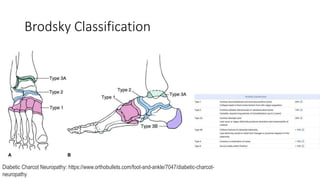 charcot Neuroarthropathy in orthopaedics | PPTX