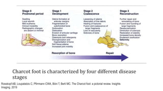 charcot Neuroarthropathy in orthopaedics | PPTX