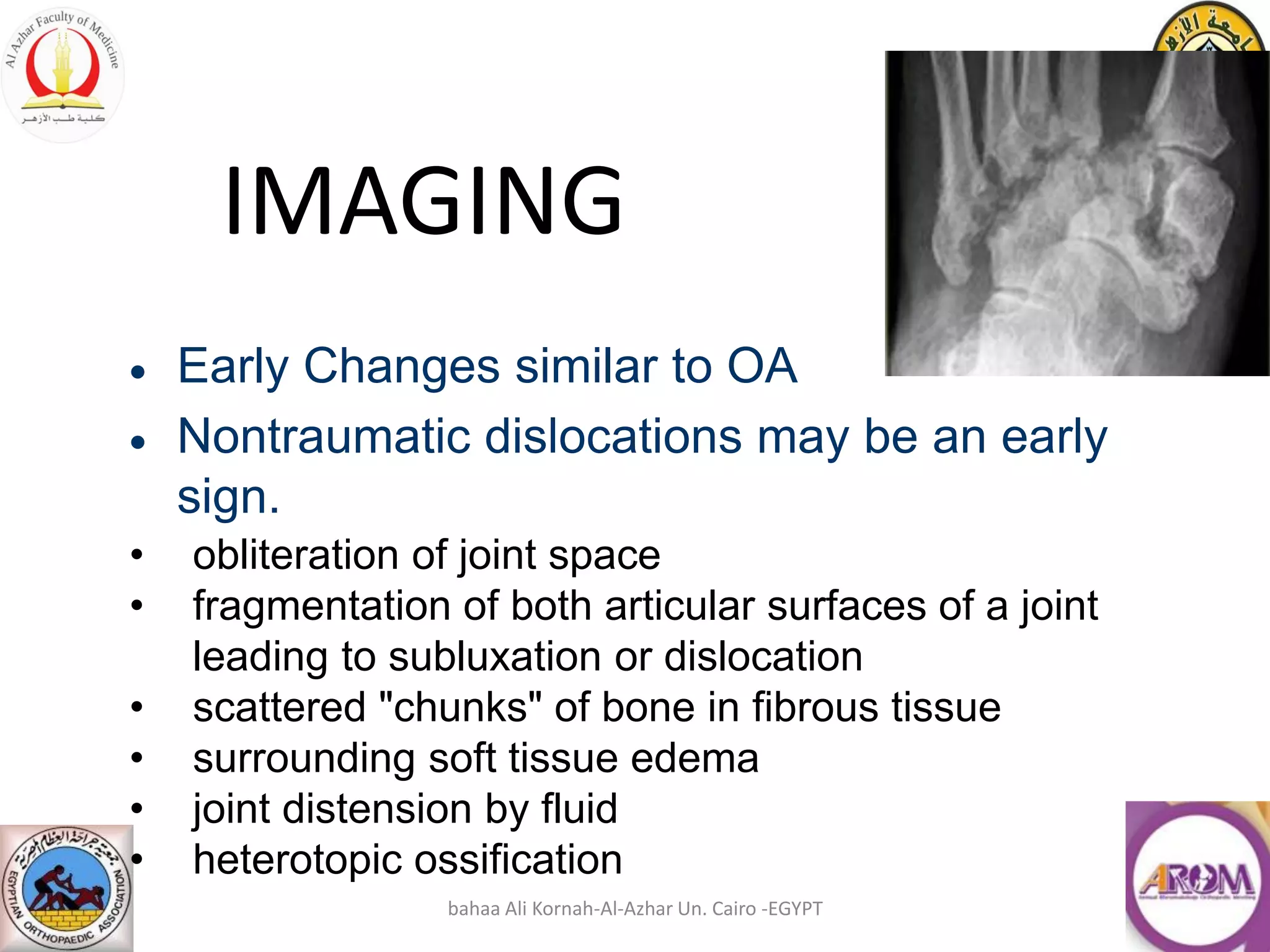 Charcot neuropathy. | PDF