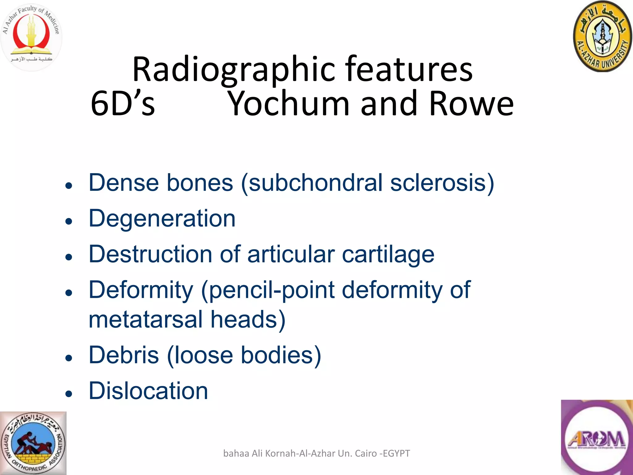 Charcot neuropathy. | PDF