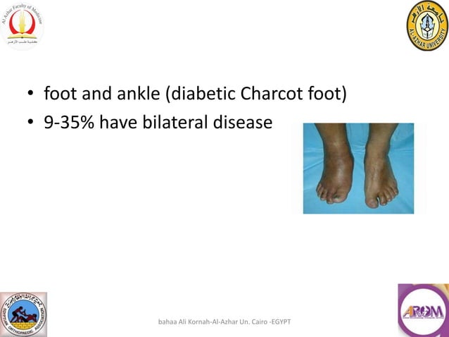 Charcot neuropathy. | PDF