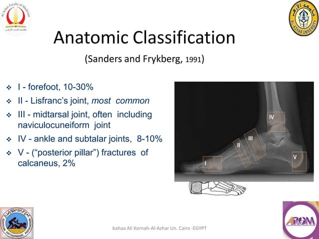 Charcot neuropathy. | PDF