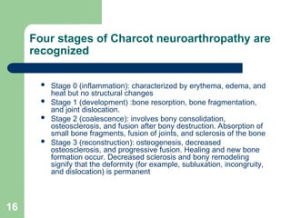 CHARCOT NEUROPATHY of human body in physiotherapy | PPT