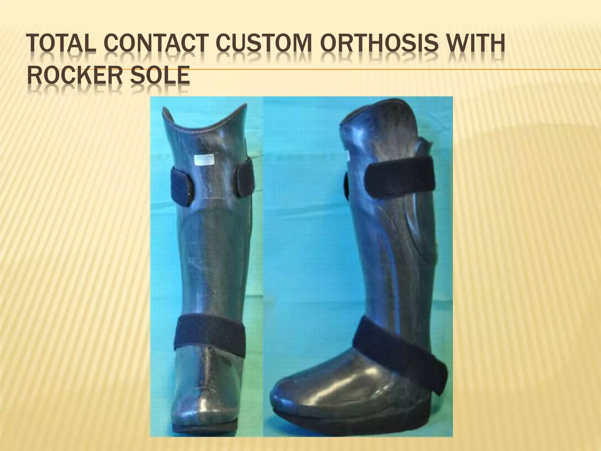 Charcot joint arthropathy and rehabilitation management | PPTX