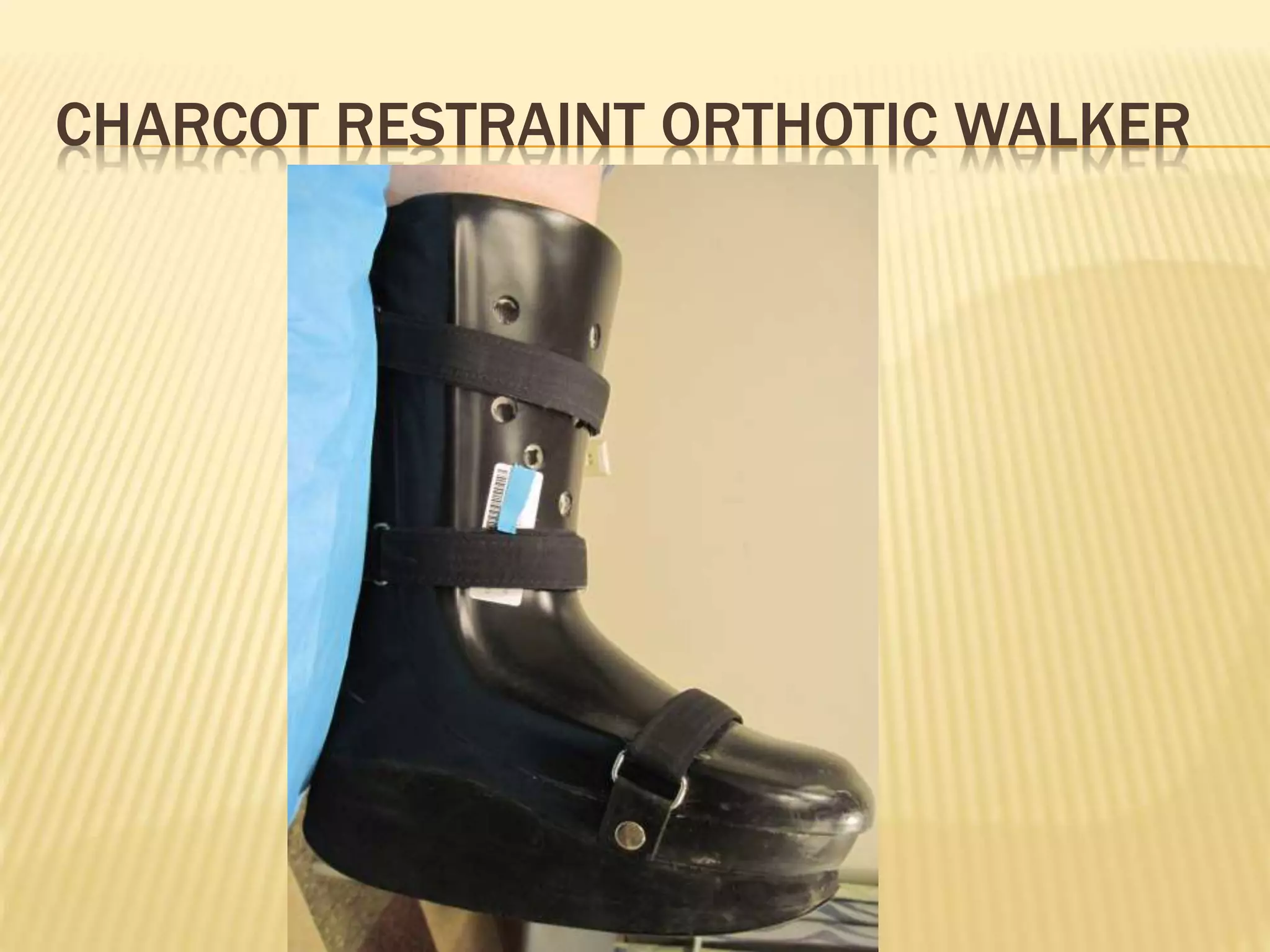 Charcot joint arthropathy and rehabilitation management | PPTX