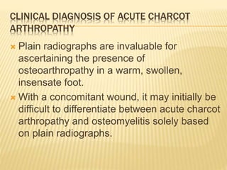 Charcot joint arthropathy and rehabilitation management | PPTX