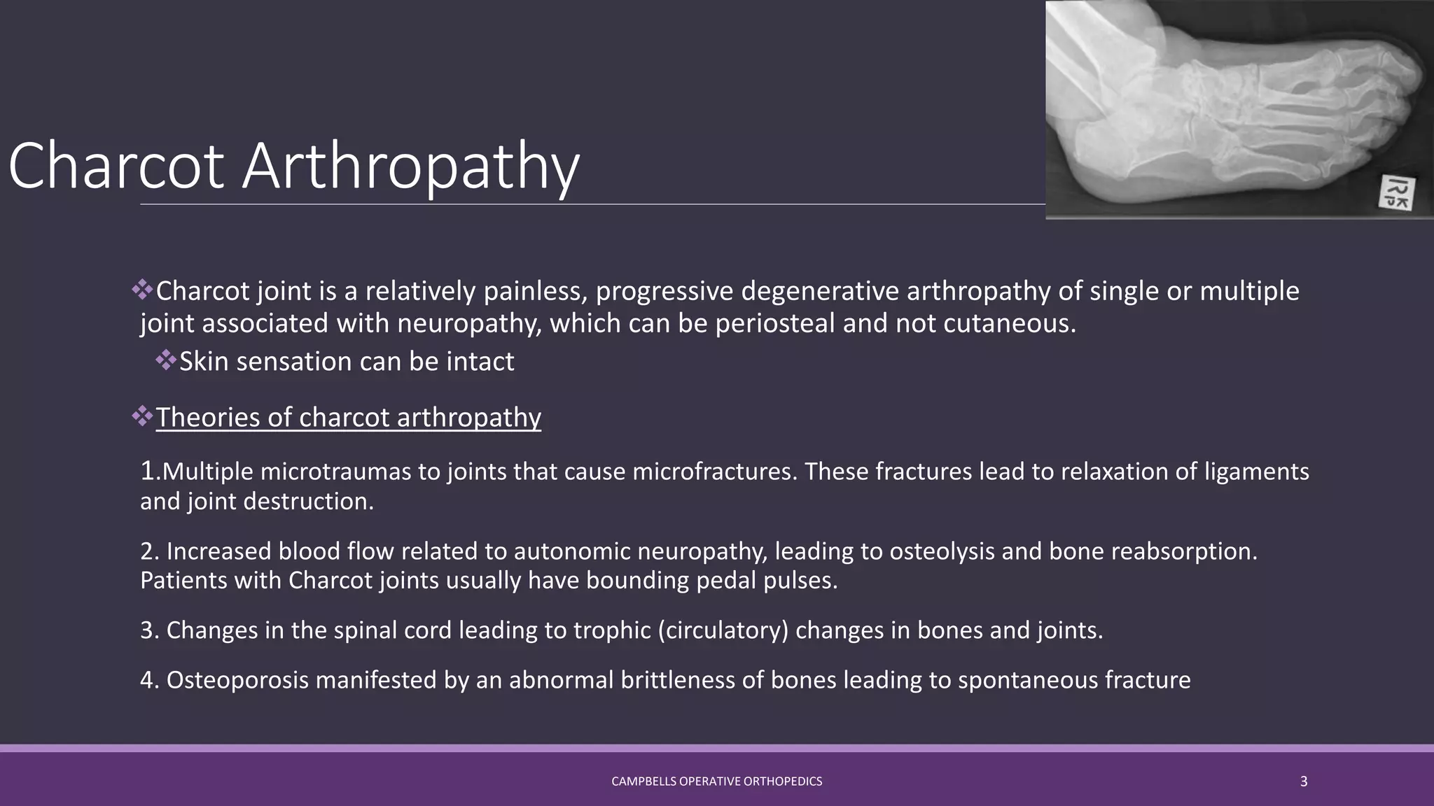 Charcot Restraint Orthotic Walker | PPTX