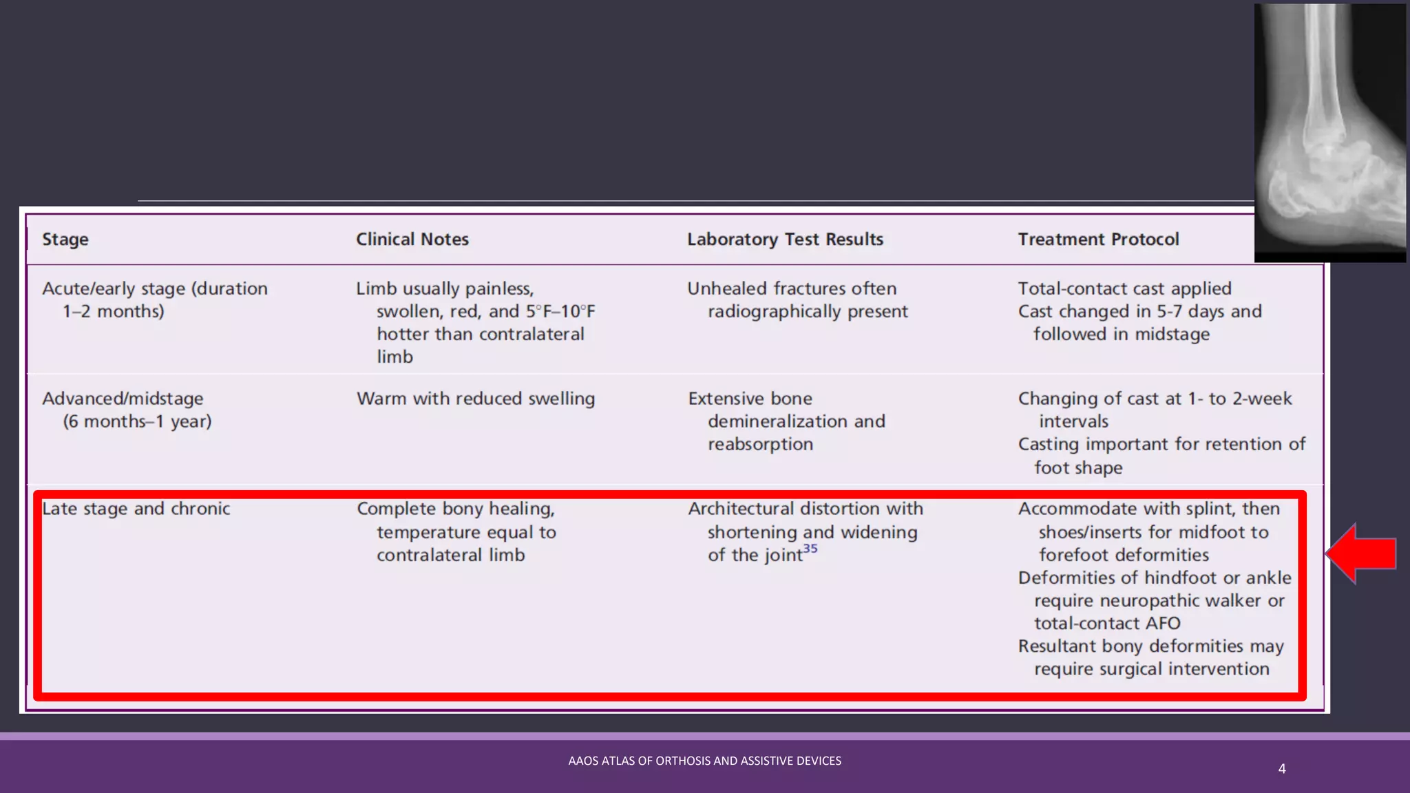 Charcot Restraint Orthotic Walker | PPTX