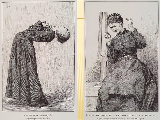Charcot's Photographic Icongraphy of Hysteria