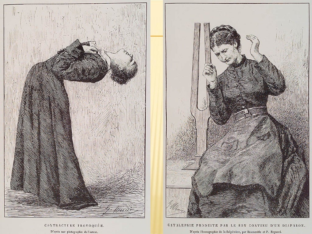 Charcot's Photographic Icongraphy of Hysteria