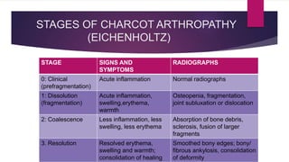CHARCOT'S JOINT- ORTHOPEDIC PRESENTATION.pptx