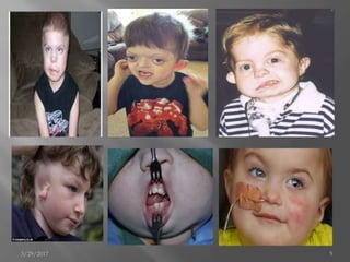 Charged syndrome | PPT