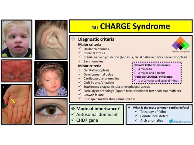 CHARGE SYNDROME.pptx | Ear, Nose and Throat Conditions | Diseases and ...