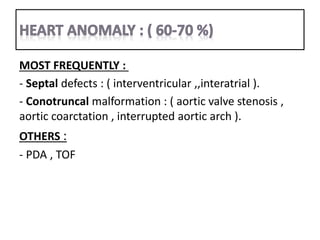 CHARGE SYNDROME.pptx