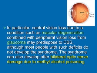 Charles bonnet syndrome | PPT