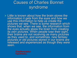 Charles bonnet syndrome | PPT