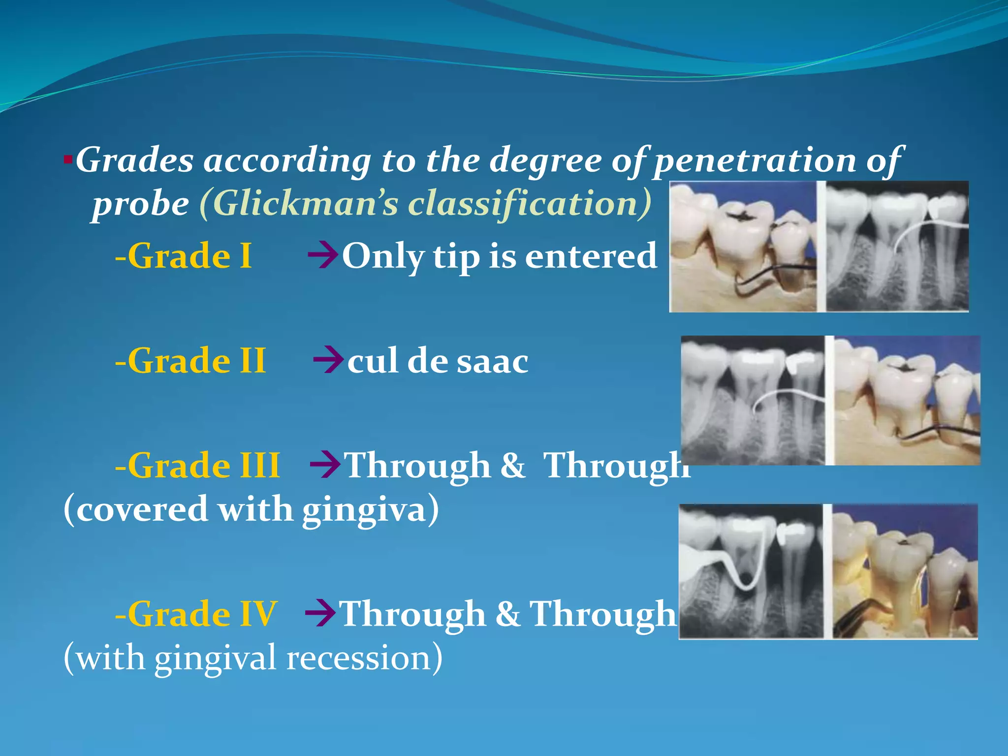 Periodontal Chart presentation | PPT