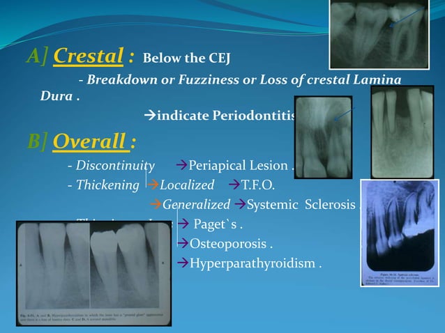 Periodontal Chart presentation | PPT | Oral care | Personal Care