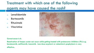 Pharmacology II Malignant Hematology Therapeutics | PDF