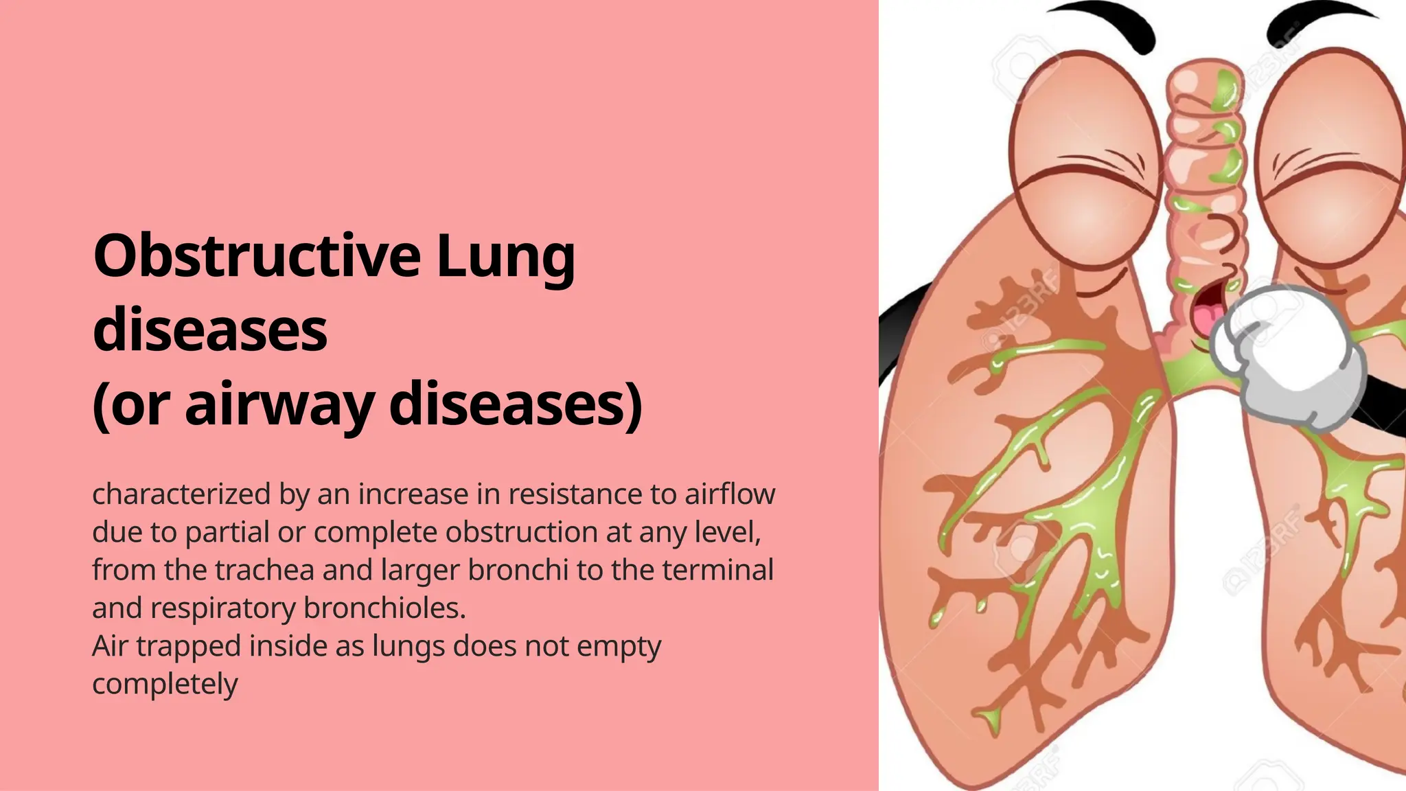Lung, Robbins Pathology , COPD, Chronic Bronchitis | PPTX