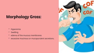 Lung, Robbins Pathology , COPD, Chronic Bronchitis | PPTX