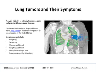 Lung Tumors: CyberKnife Treatment Overview | PDF