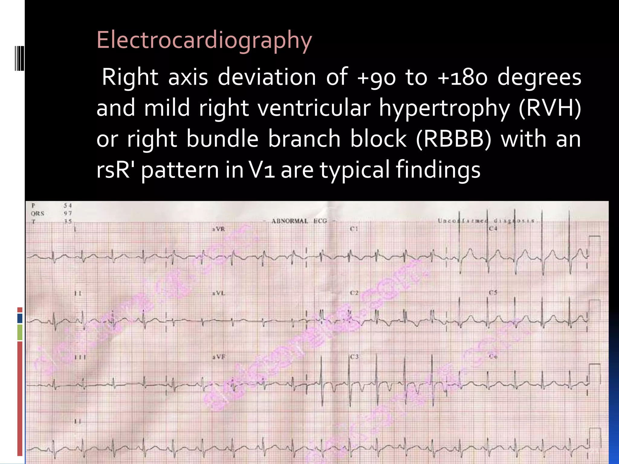 CONGENITAL HEART DISEASES | PPTX