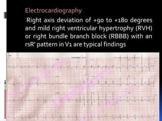 CONGENITAL HEART DISEASES | PPTX